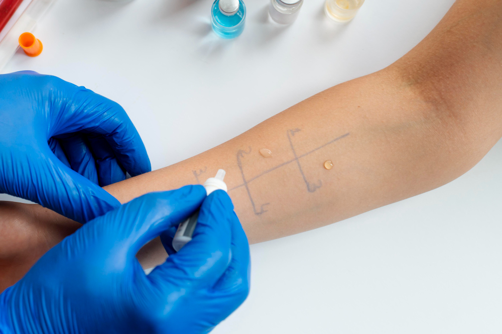 Allergy Shots Really Work: We Answer All of Your Questions ...